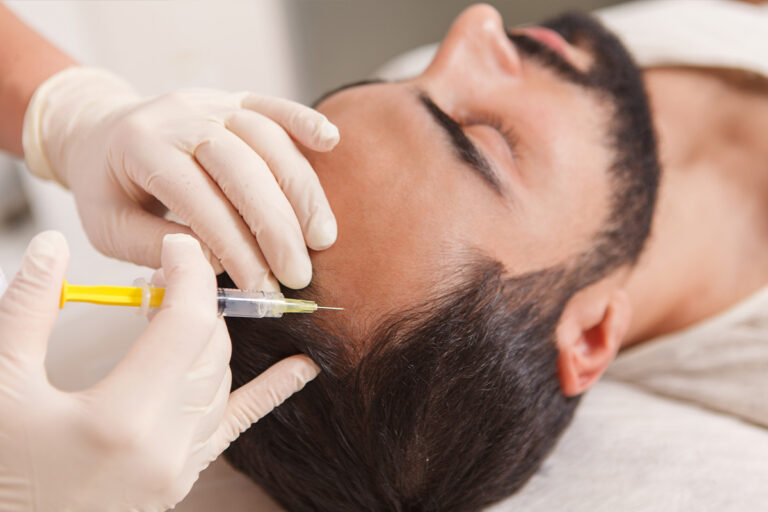 Hair Restoration - Morpheus Medical Aesthetics